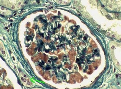 El Cuerpo Humano: Endotelio