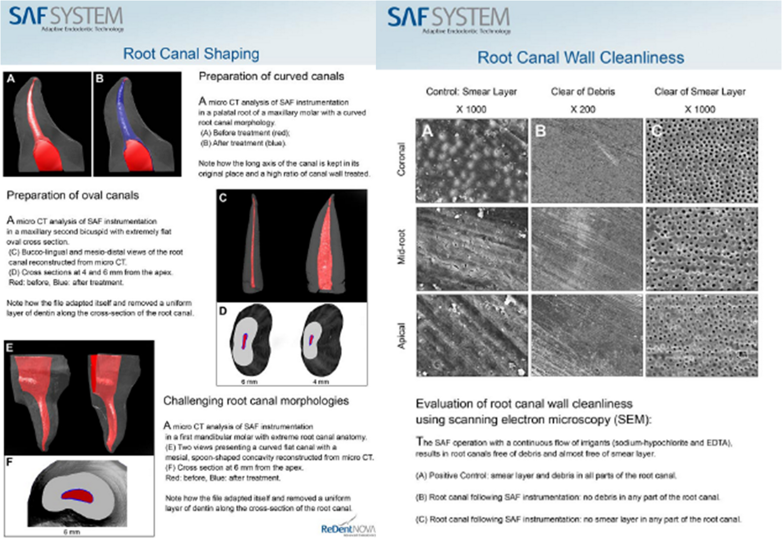 SAF SYSTEM - The NEW