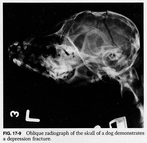 Life & Science: Bone Fractures!!!