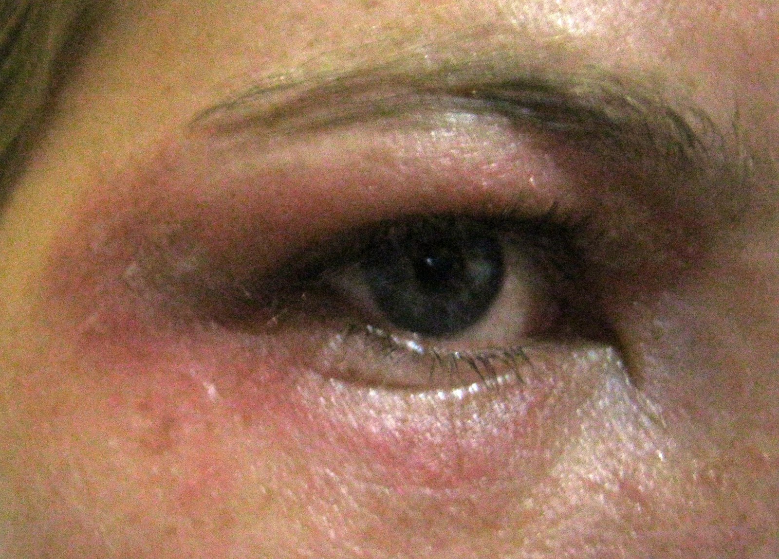 Adventures : Newest African Disease