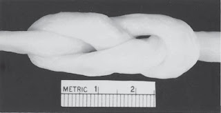 PaulaCooperBiol3500: My Favourite Tissue! - The Umbilical Cord