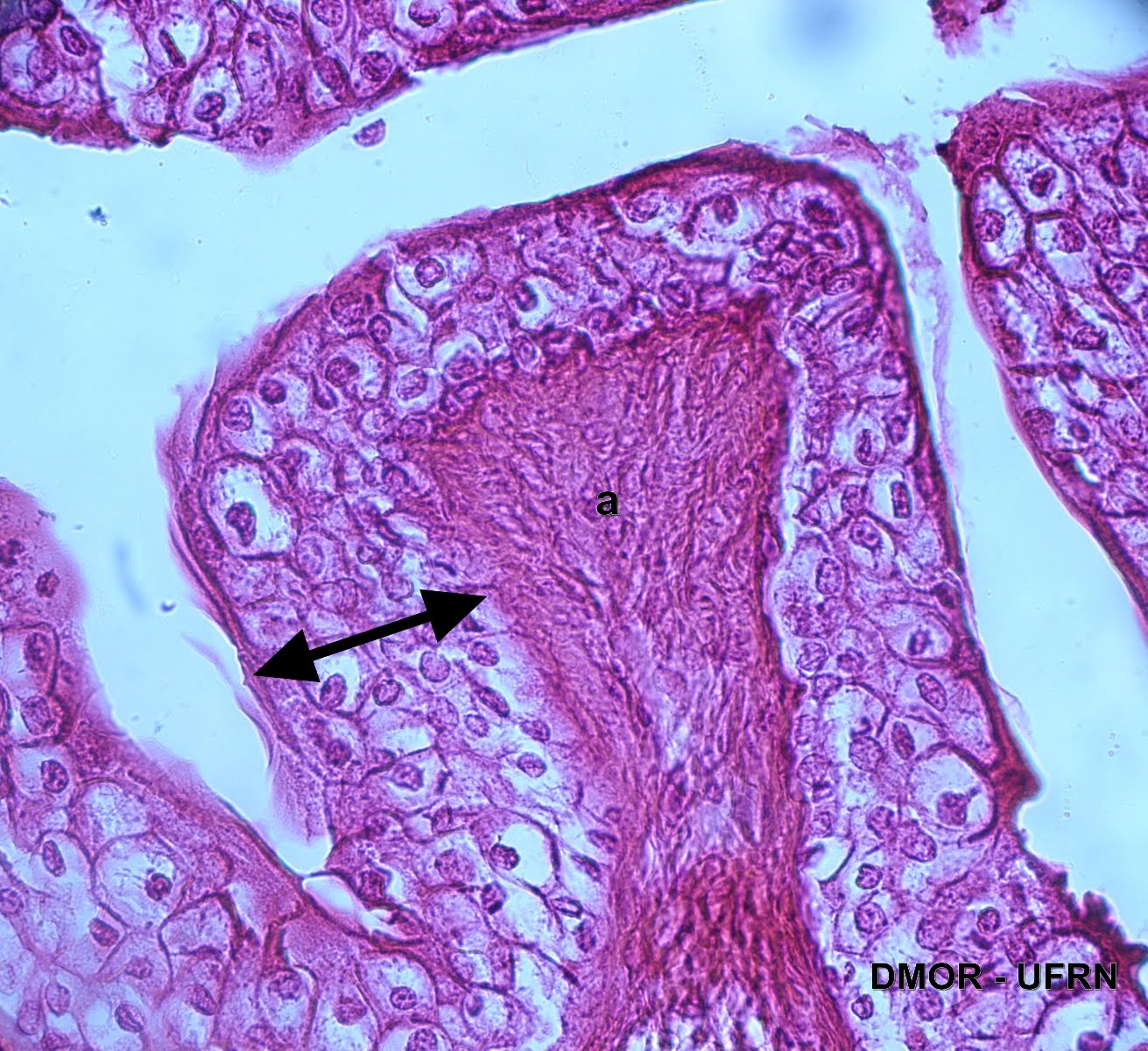 Bexiga Com Conteúdo Homogêneo - LIBRAIN