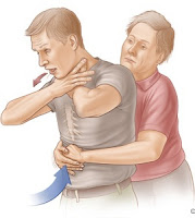 Keluarga Kita, kesehatan: Pertolongan Pertama Tersedak