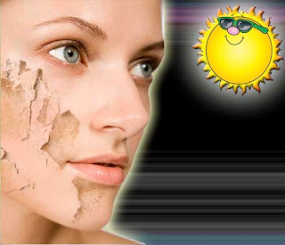 Woman Should Know's About...: Sun Damage - What are the Effects of Sun ...