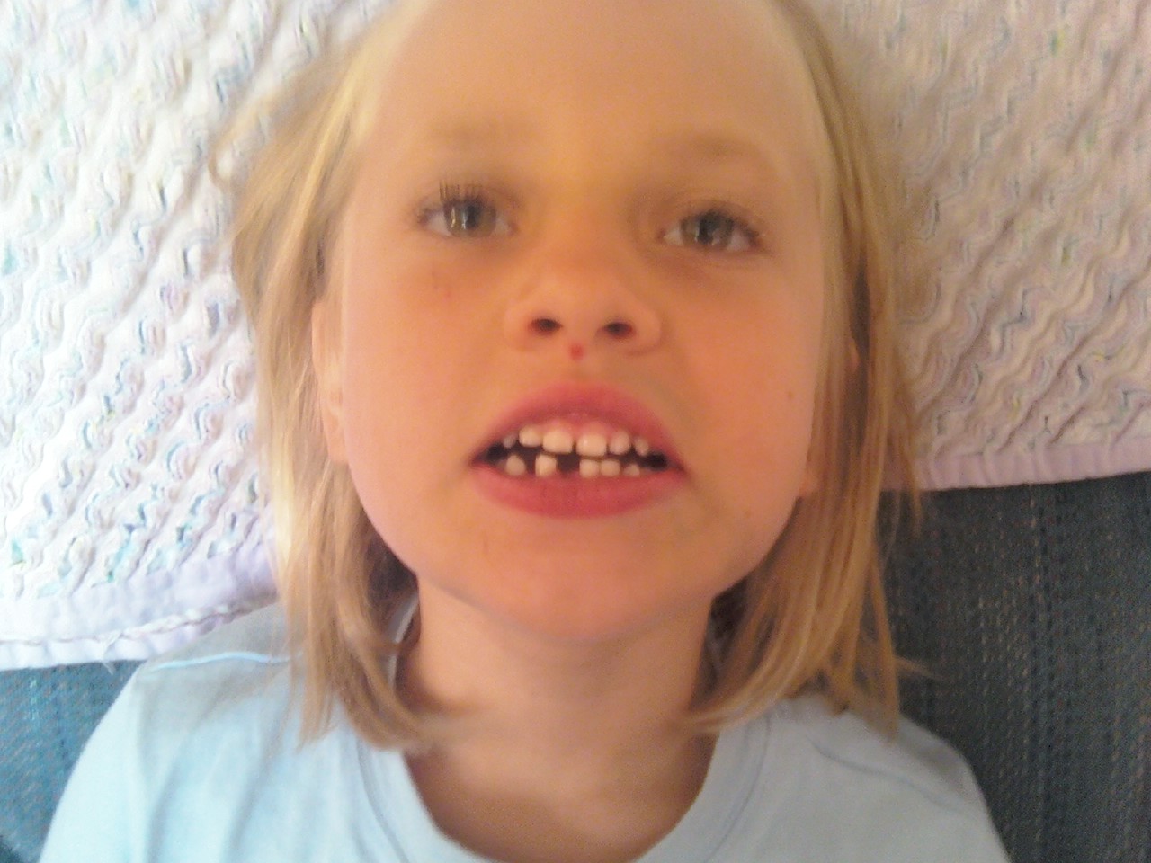 Live everyday like it's your last......: Lost a Tooth