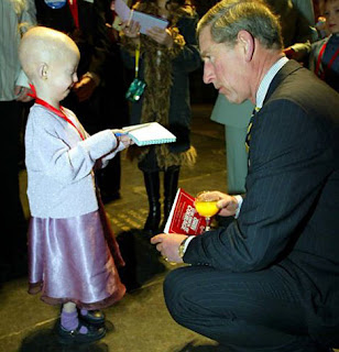 Progeria Images | Progeria Patient Videos | Progeria PAA Movie Video ...