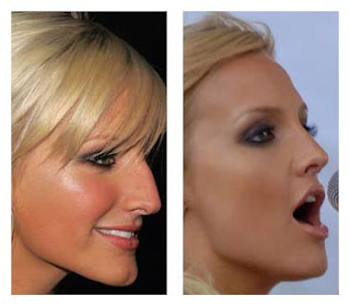 Plastic Surgery Before And After: Ashlee Simpson Nose Job