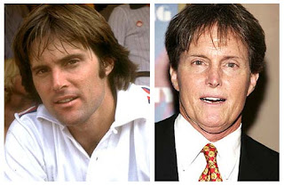 Plastic Surgery Before After: Bruce Jenner Plastic Surgery