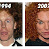 Carrot Top Plastic Surgery - Plastic Surgey Before and After
