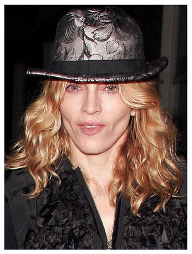 Plastic Surgery Before And After: Madonna Plastic Surgery