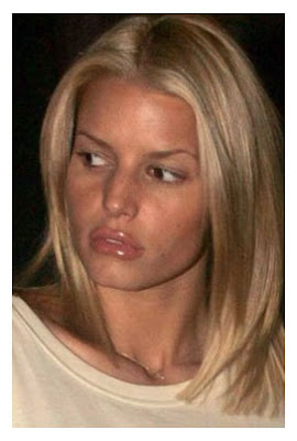 Plastic Surgery Before And After: Jessica Simpson Plastic Surgery