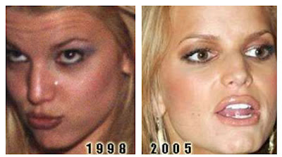 Plastic Surgery Before And After: Jessica Simpson Plastic Surgery