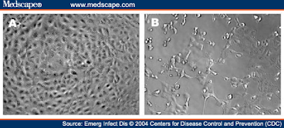 STAY TUNE TO V.R.S: Methods of study of viruses