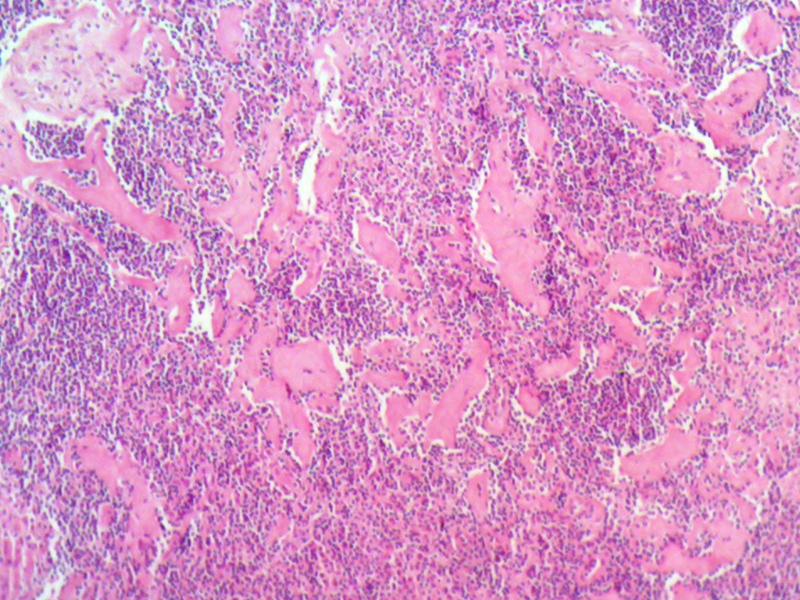 HISTOPATHOLOGY: Mesenteric lymph nodes