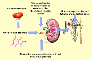 alfiyan nurse: GAGAL GINJAL KRONIK