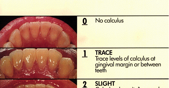Dental Hygiene Appointments