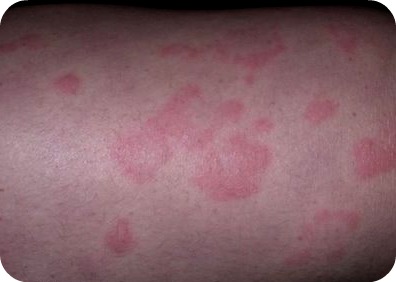 miRRah 89: LapaR gaREm @ sopak Garam