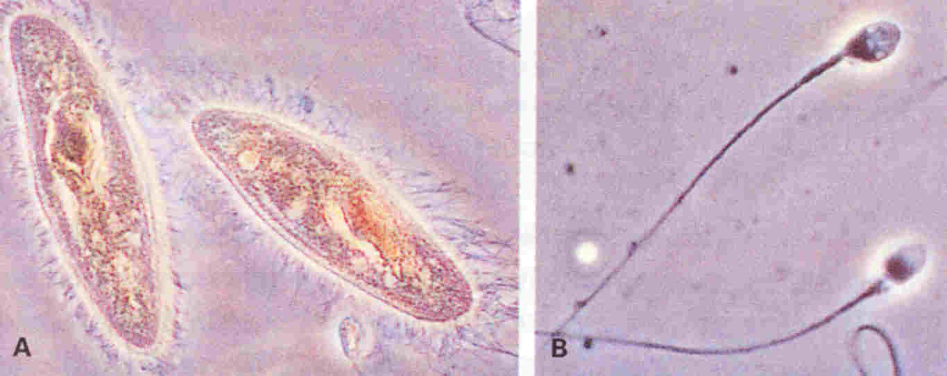morfofisiologia celular: QUIMIOTAXIS EUCARIOTA
