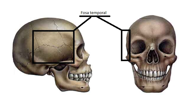 digestivouq: Fosa temporal por John Darío Mora