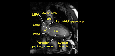 MRI BLOG: Cardiac Anatomy