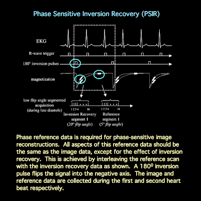 MRI BLOG: Pulse Sequences for Cardiac MRI