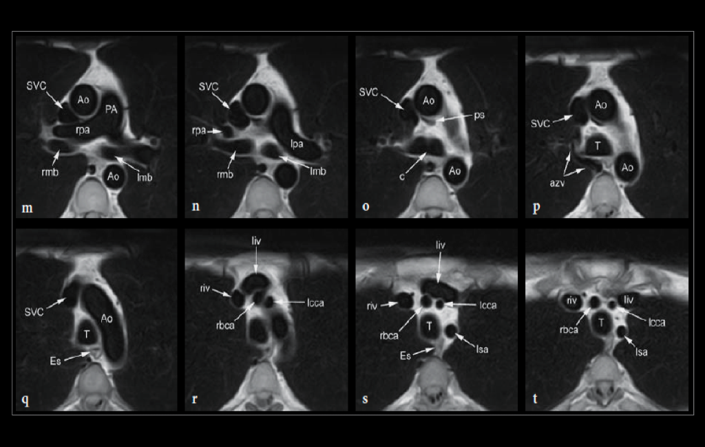 MRI BLOG: Detailed CMR Anatomy