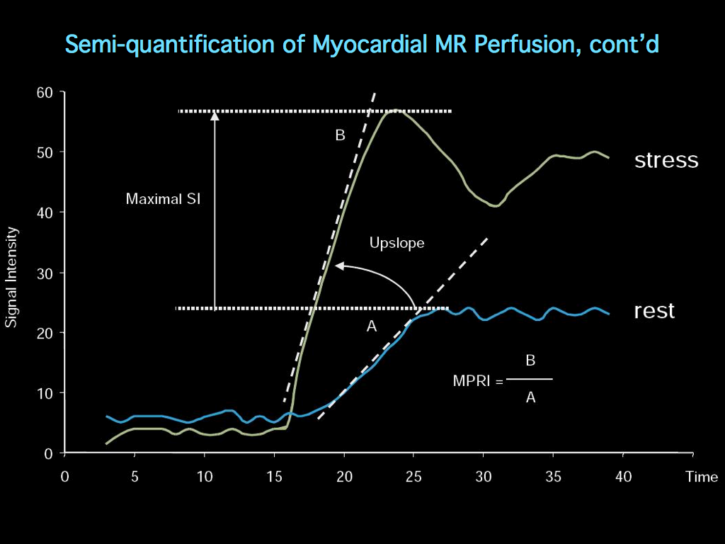 MRI BLOG: Myocardial MR Perfusion - Semiquantification