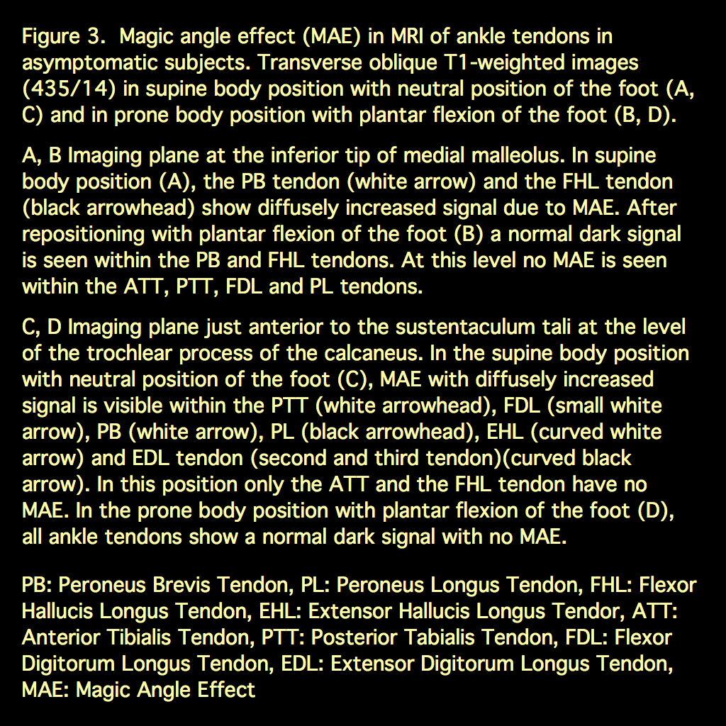 MRI BLOG: Magic Angle Phenomenon