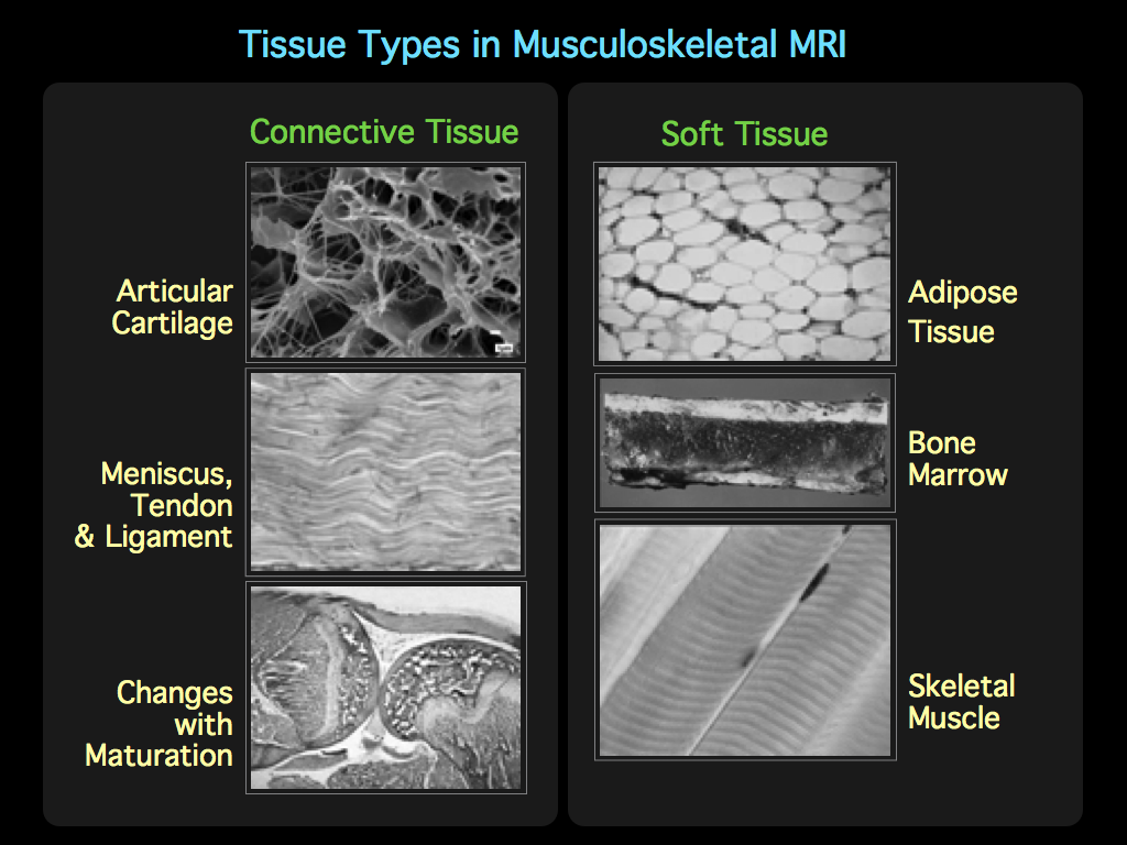 MRI BLOG: Musculoskeletal MRI 101 (I/II)