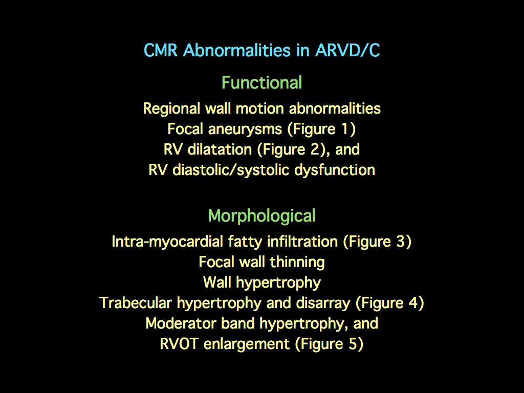 MRI BLOG: Arrhythmogenic Right Ventricular Dysplasia/Cardiomyopathy ...