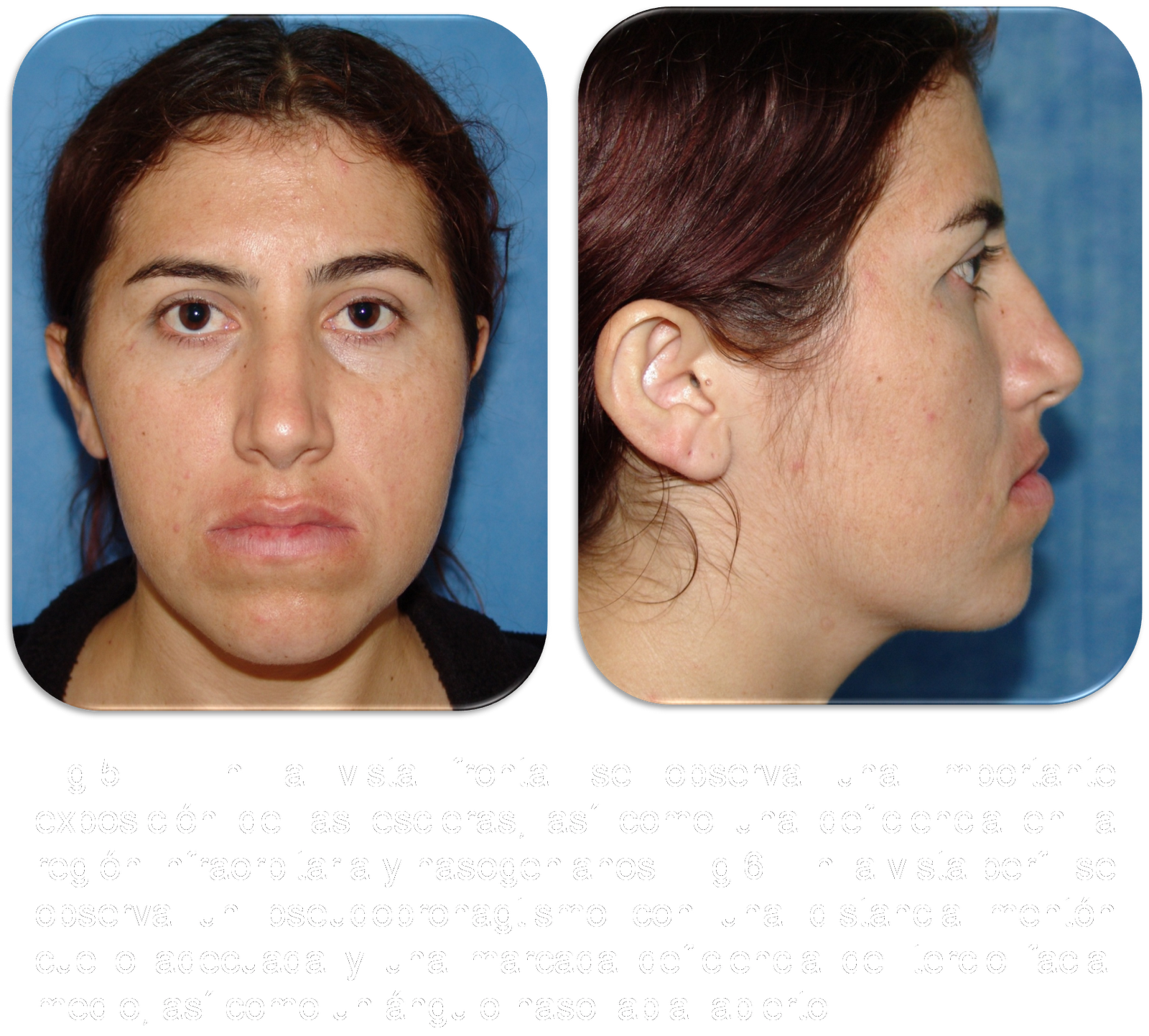 Ortodoncia y Ortopedia dentofacial: HERRAMIENTAS PARA EL DIAGNOSTICO DE ...