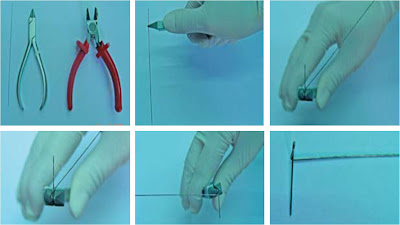 ORTODONTIA CONTEMPORÂNEA: Sliding Jig: confecção e mecanismo de ação