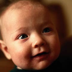 My Story in Medicine: Baby's head shape: What's normal?