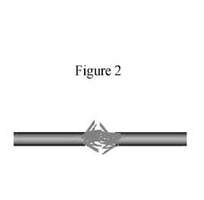 Dermatology Top Secrets: Hair shaft abnormalities