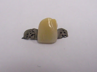 My dentists: Maryland Bridge