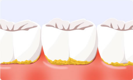PREPARAR AL USUARIO PARA LA VALORACIÓN Y TOMA DE RADIOGRAFÍAS ORALES ...