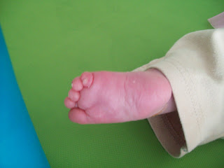 Adventures with Triangles: Woes about Toes