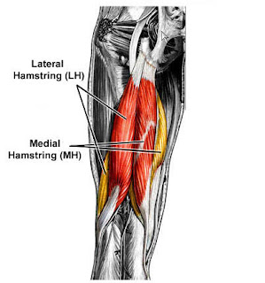 pulled hamstring treatment
