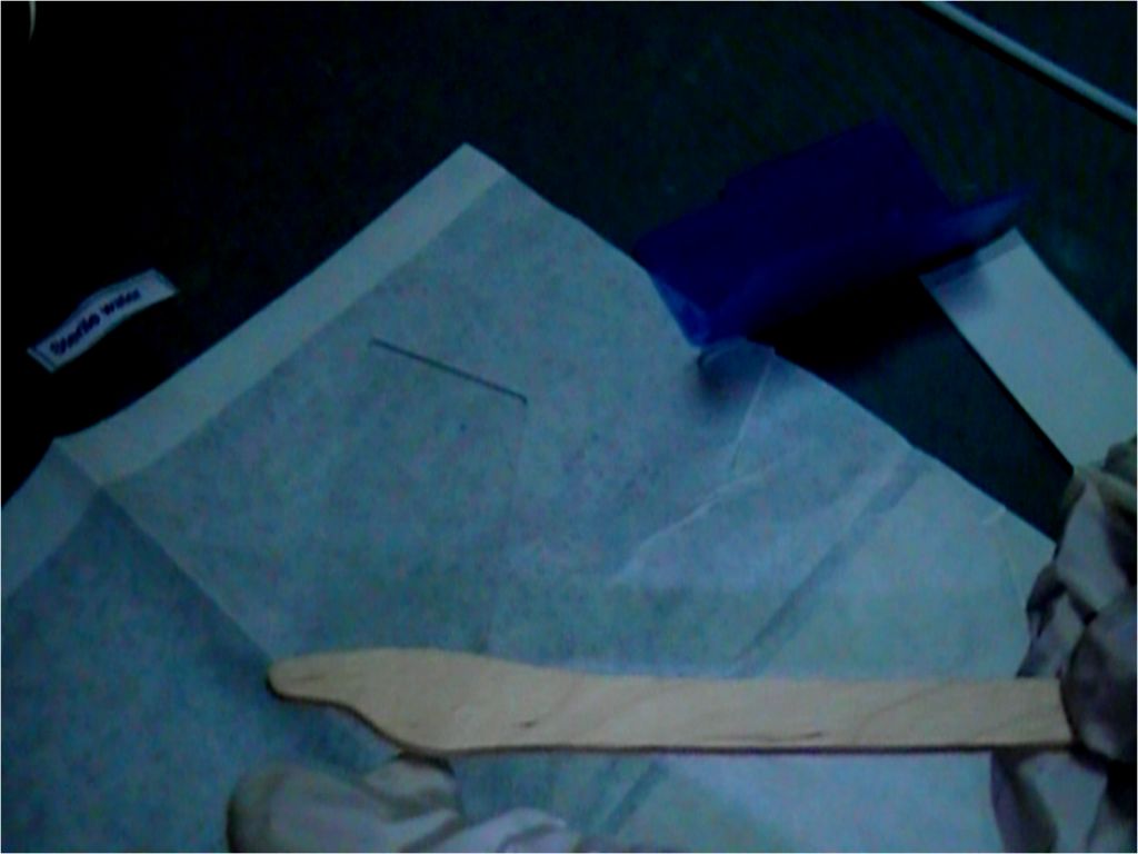 My Medical Notes: Pap Smear Technique