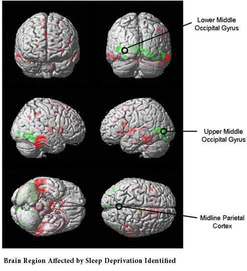 TL's Journey of Life (Chapter one): Sleep Deprivation