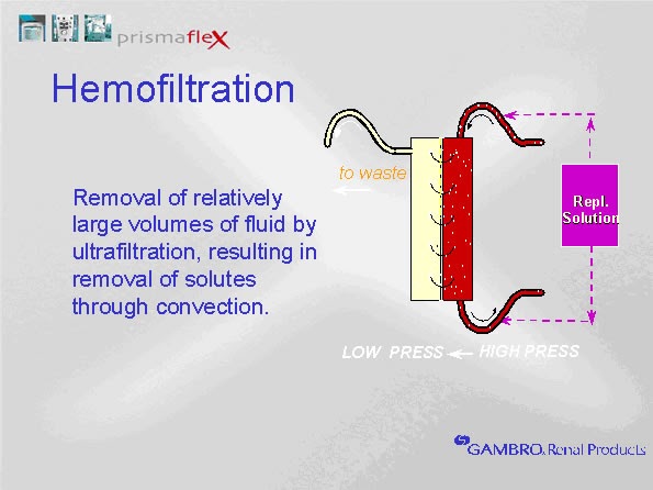 Renal Fellow Network: High Flux versus Hemofiltration