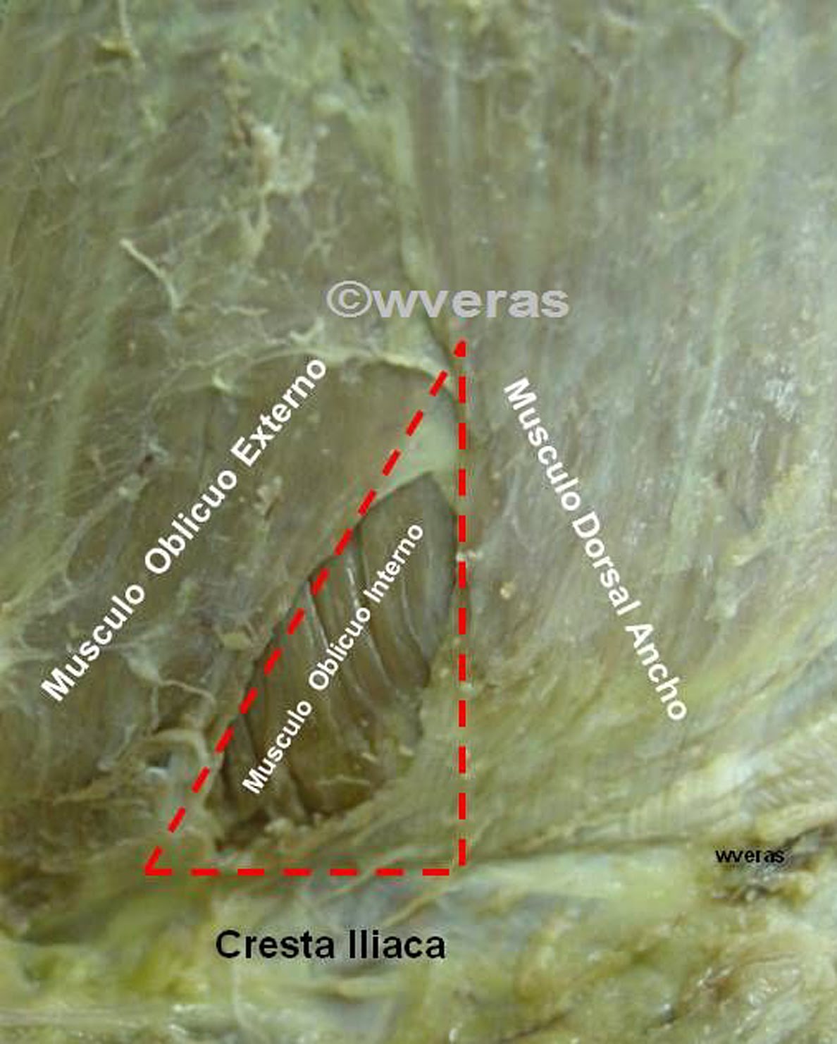 agosto | 2010 | Anatomía Fenestra