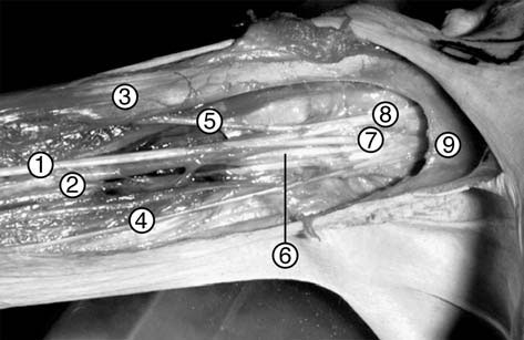 Taysir assistance الإسعاف الطبي تيسير: Dissection du plexus brachial ...