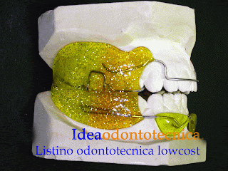 Odontotecnica Low Cost: Frankel II