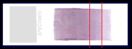 CARA PEMBUATAN PREPARAT DARAH TEPI - ilmu kesehatan