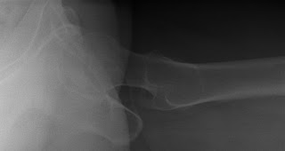 ICandy NZ: X-Ray Timeline