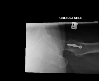ICandy NZ: X-Ray Timeline