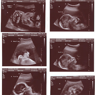 810 House and Garden: 24 Week Ultrasounds