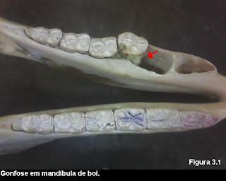 Artrologia: Articulações Fibrosas
