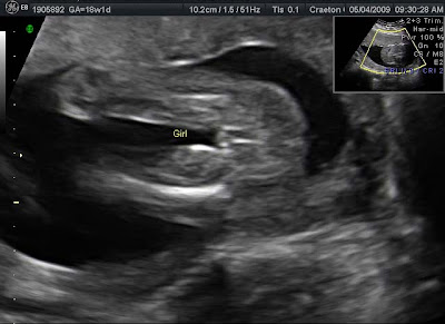 Livin' la Vida Roko: Ultrasound - 18 weeks